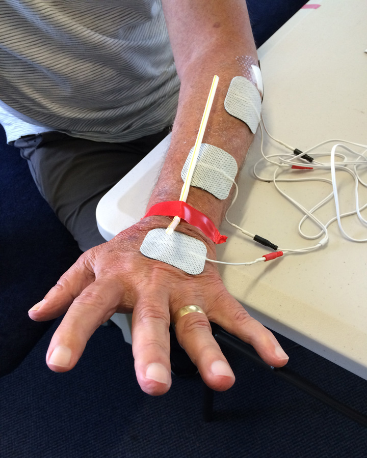 Central Coast Neuro Rehab | Stroke Exercise Therapy